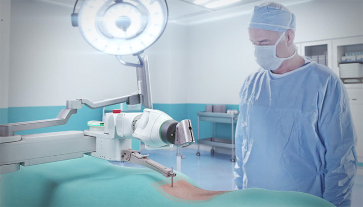 Top 5 small robotic systems for minimally invasive surgeries (MIS ...